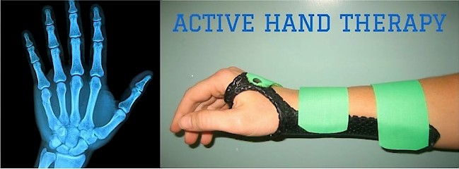 Active Hand Therapy News – Active Hand Therapy